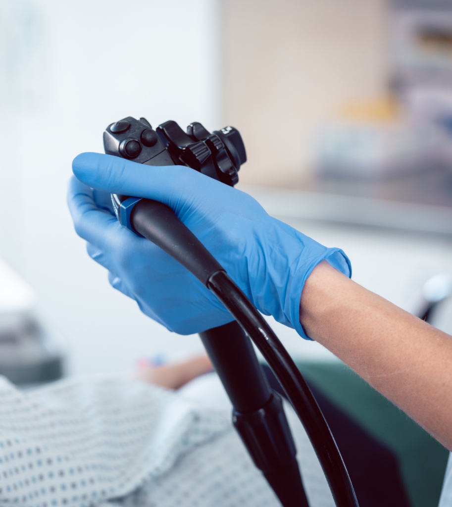 Upper Endoscopy – SoCal Gastroenterology